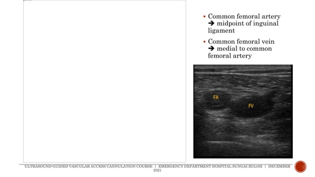 FEMORAL VEIN CANNULATION.pptx | Blood Disorders | Diseases and Conditions