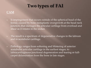 Femoroacetabular impingement | PDF