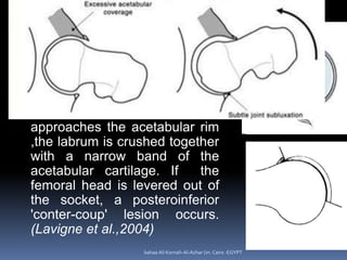 Femoroacetabular impingement (FAI) | PPT
