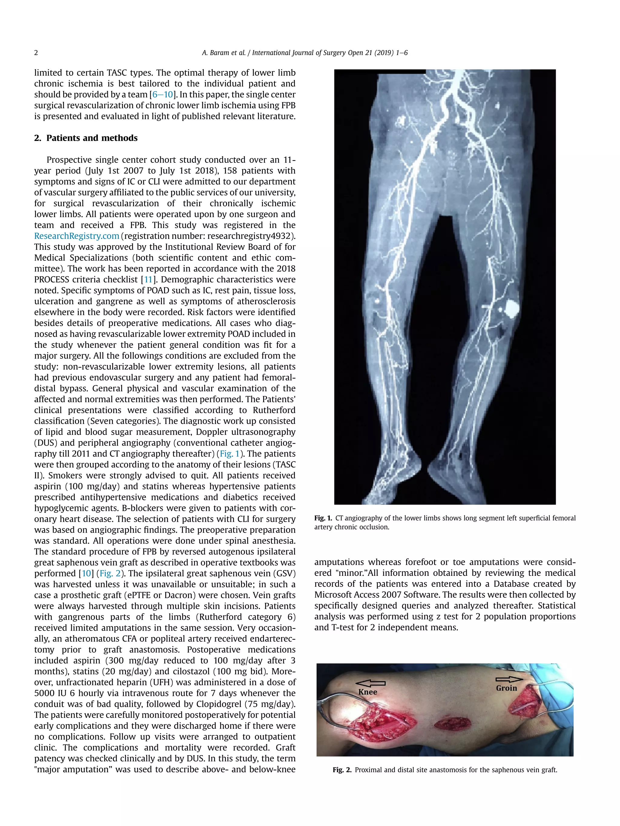 Femoropopliteal bypass for revascularization of chronic ischemia of ...