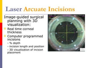 FemtoCataract Surgery - Is this the Future? | PPT