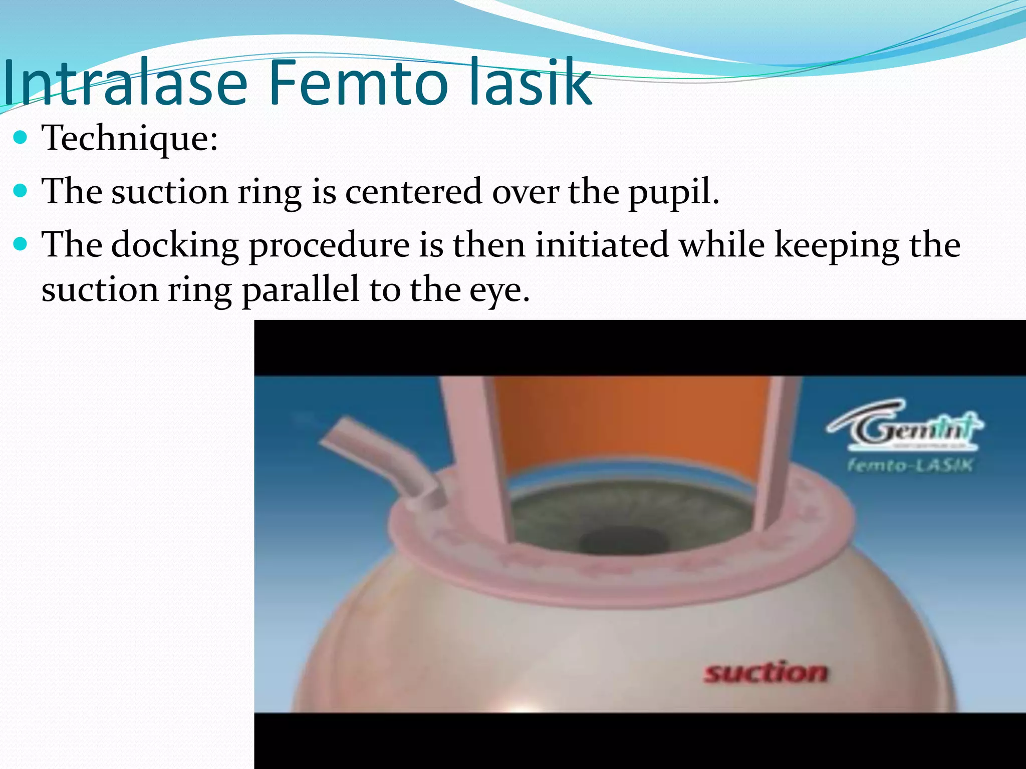 Femtosecond laser | PPTX