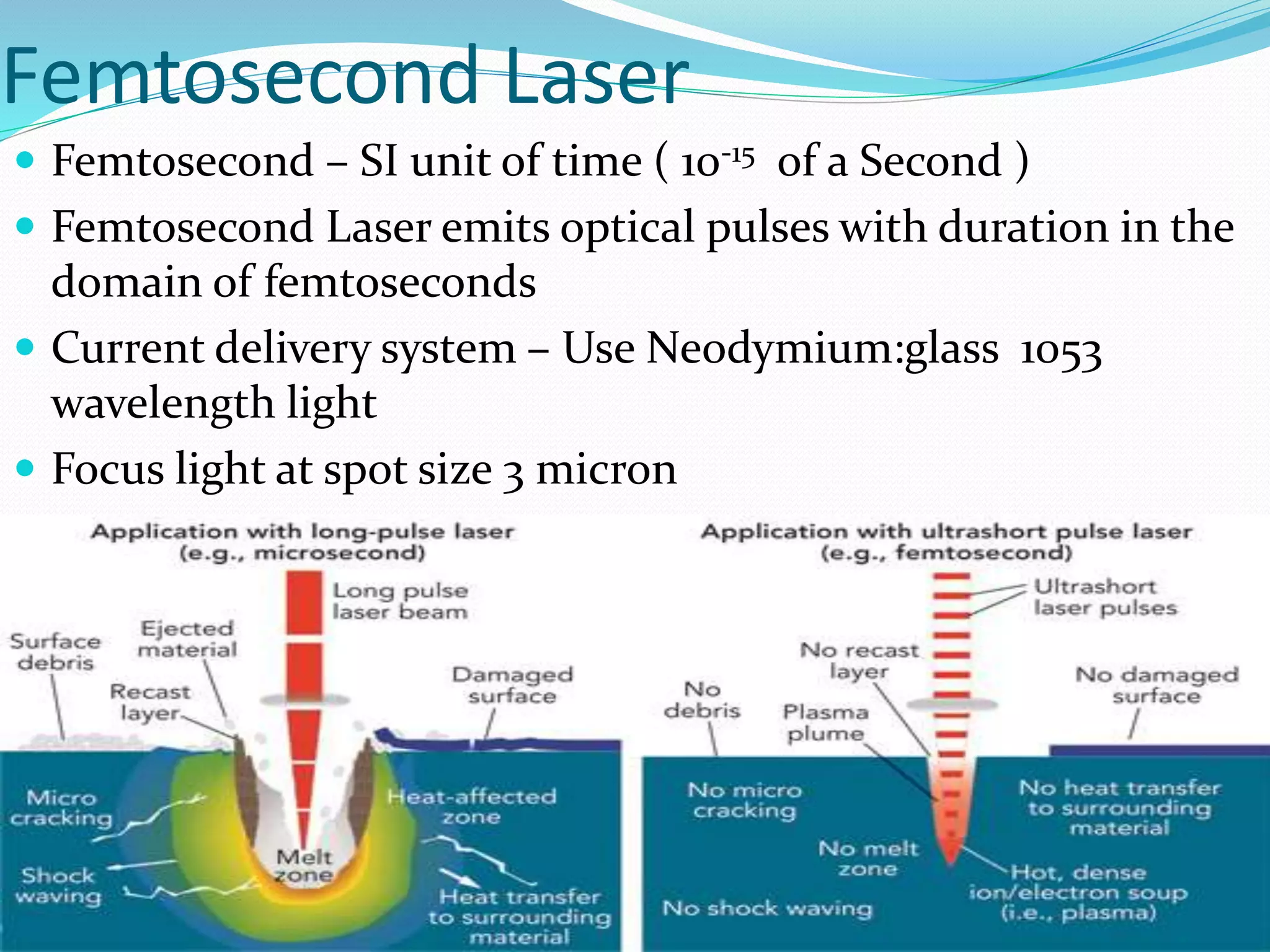 Femtosecond Laser Cataract Surgery Guide | PPT