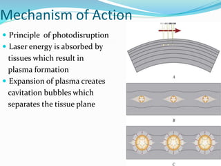 Femtosecond laser | PPTX