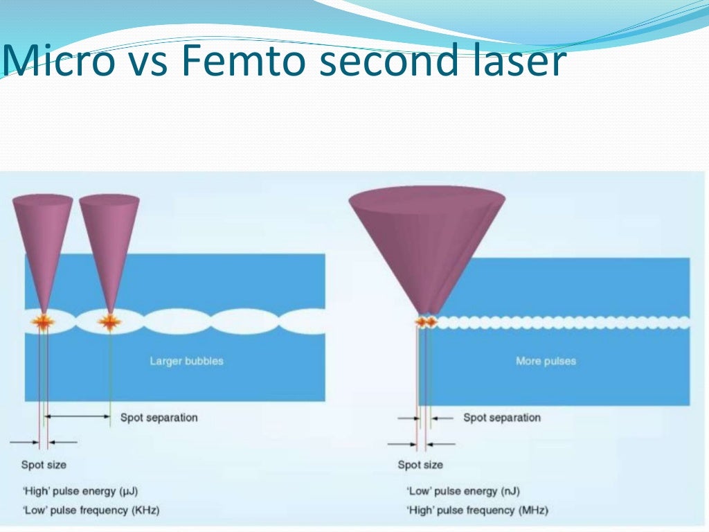 Femtosecond laser