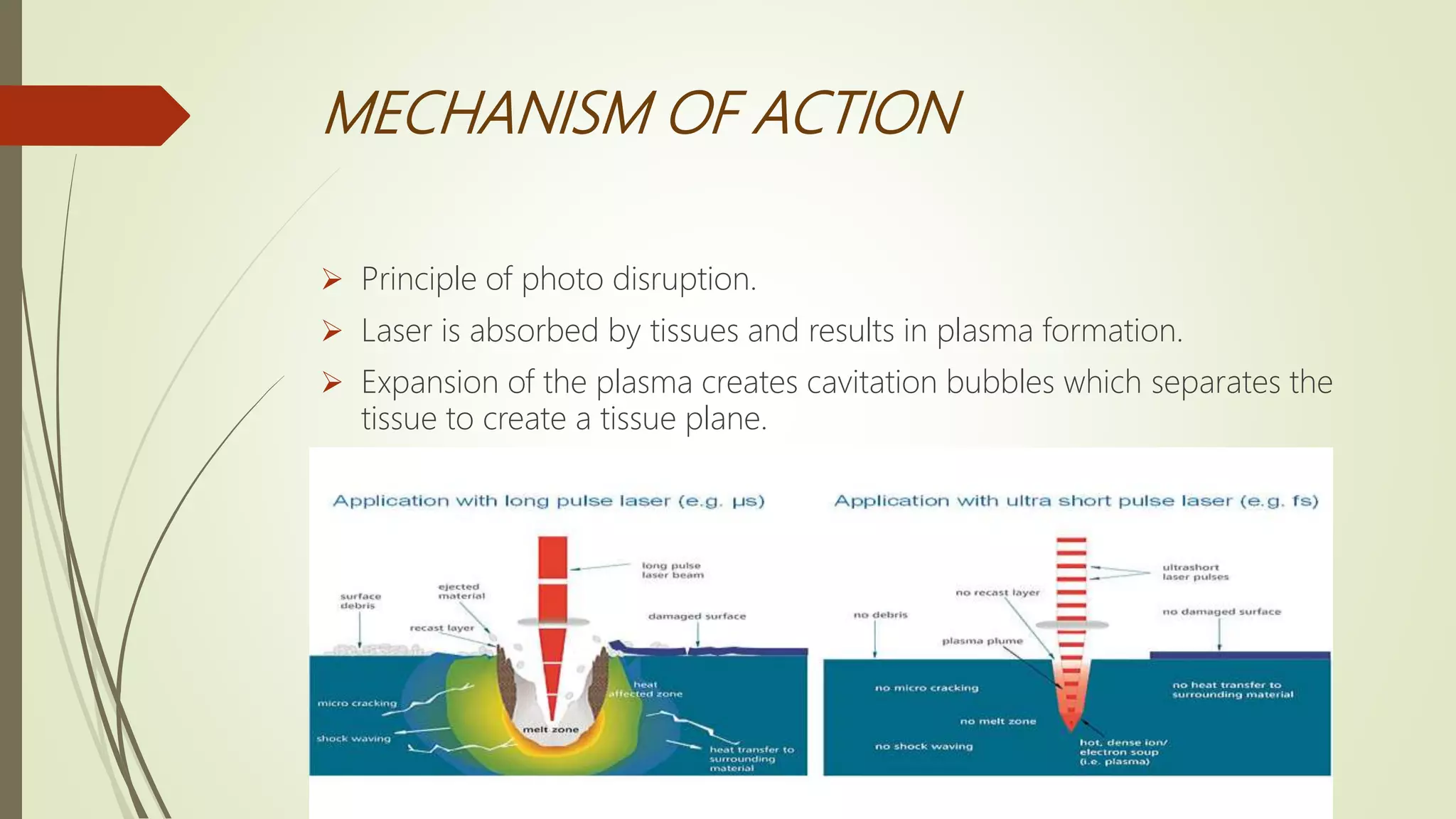 Femtosecond laser assisted cataract surgery | PPTX