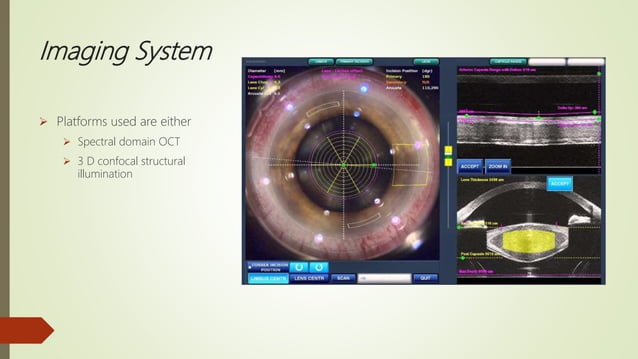 Femtosecond laser assisted cataract surgery | PPTX