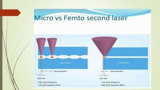Femtosecond laser assisted cataract surgery | PPTX