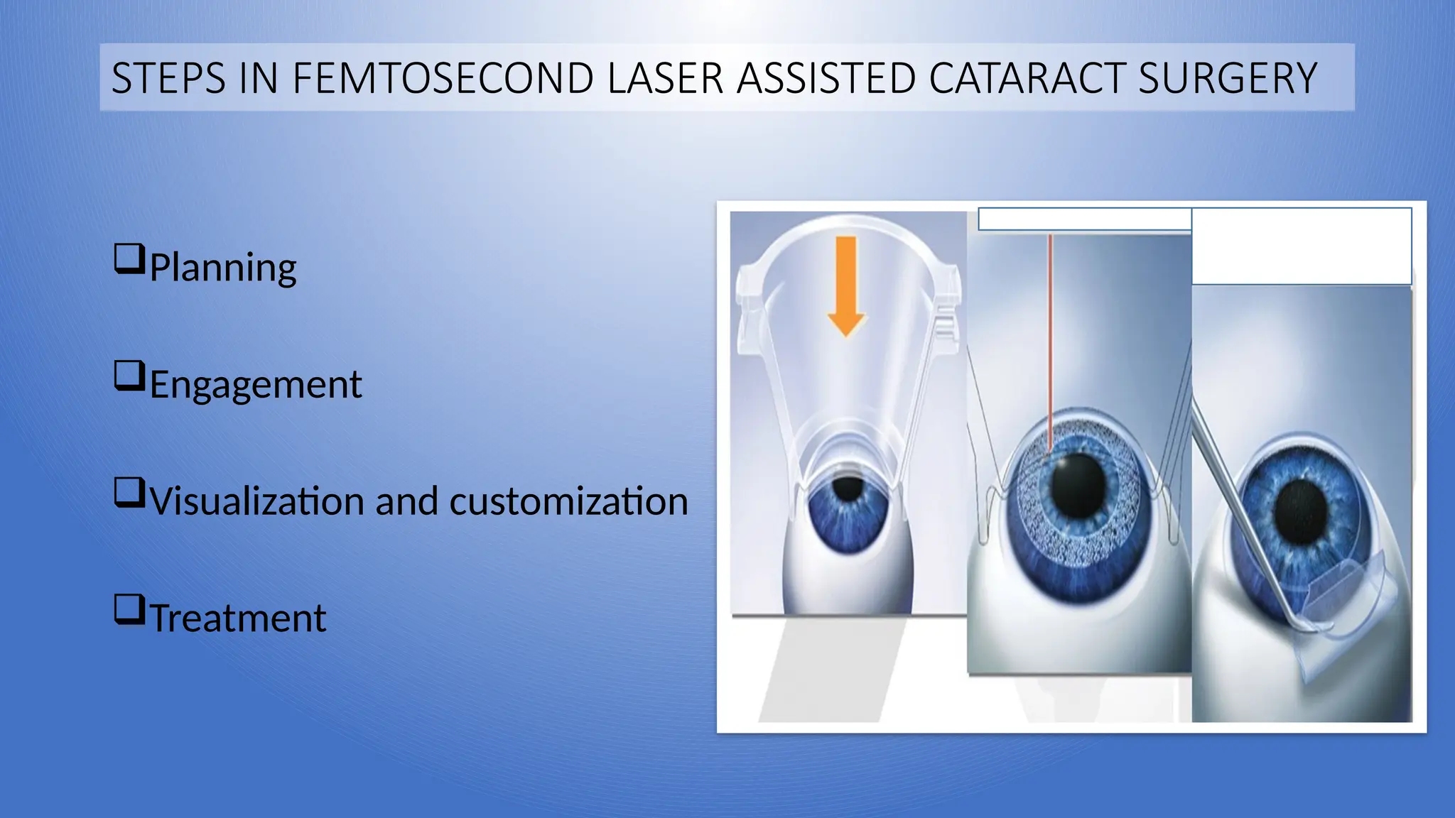 FEMTOSECOND LASER CATARACT SURGERY IN OPTOMETRY.pptx