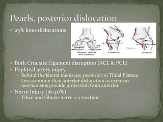 Posterior Knee Dislocation | PPT