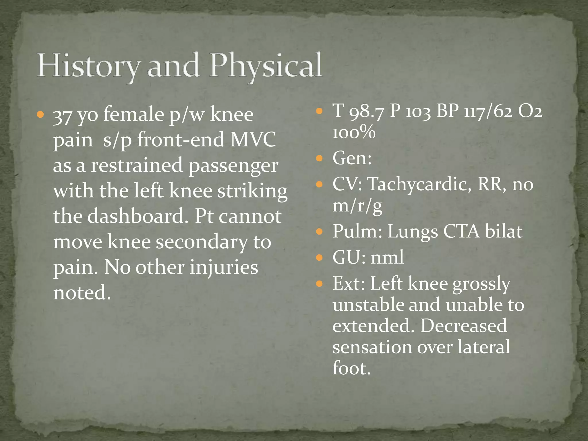 Posterior Knee Dislocation Ppt
