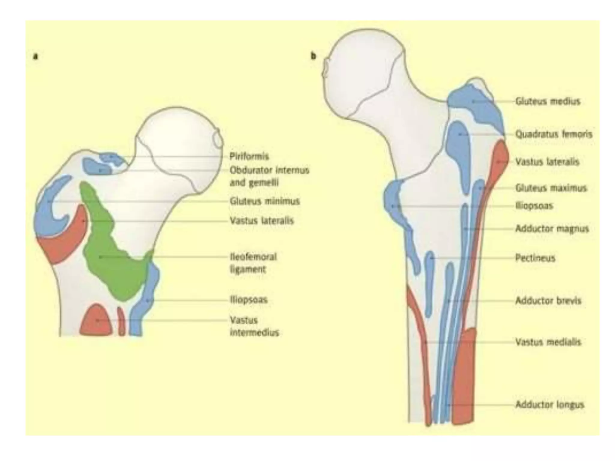 Femur 1.pptx | Death, Injury, or Military Conflict | Sensitive Topics