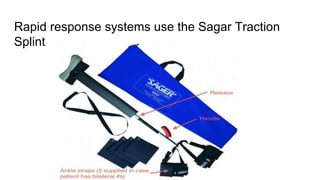 Femur and pelvic fractures | PPT