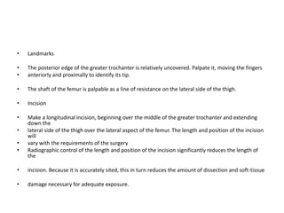 Femur approaches | PPTX