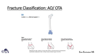Femur Fracture power point gagahagwhagahahaha | PDF