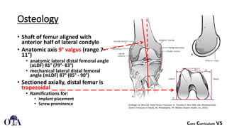 Femur Fracture power point gagahagwhagahahaha | PDF