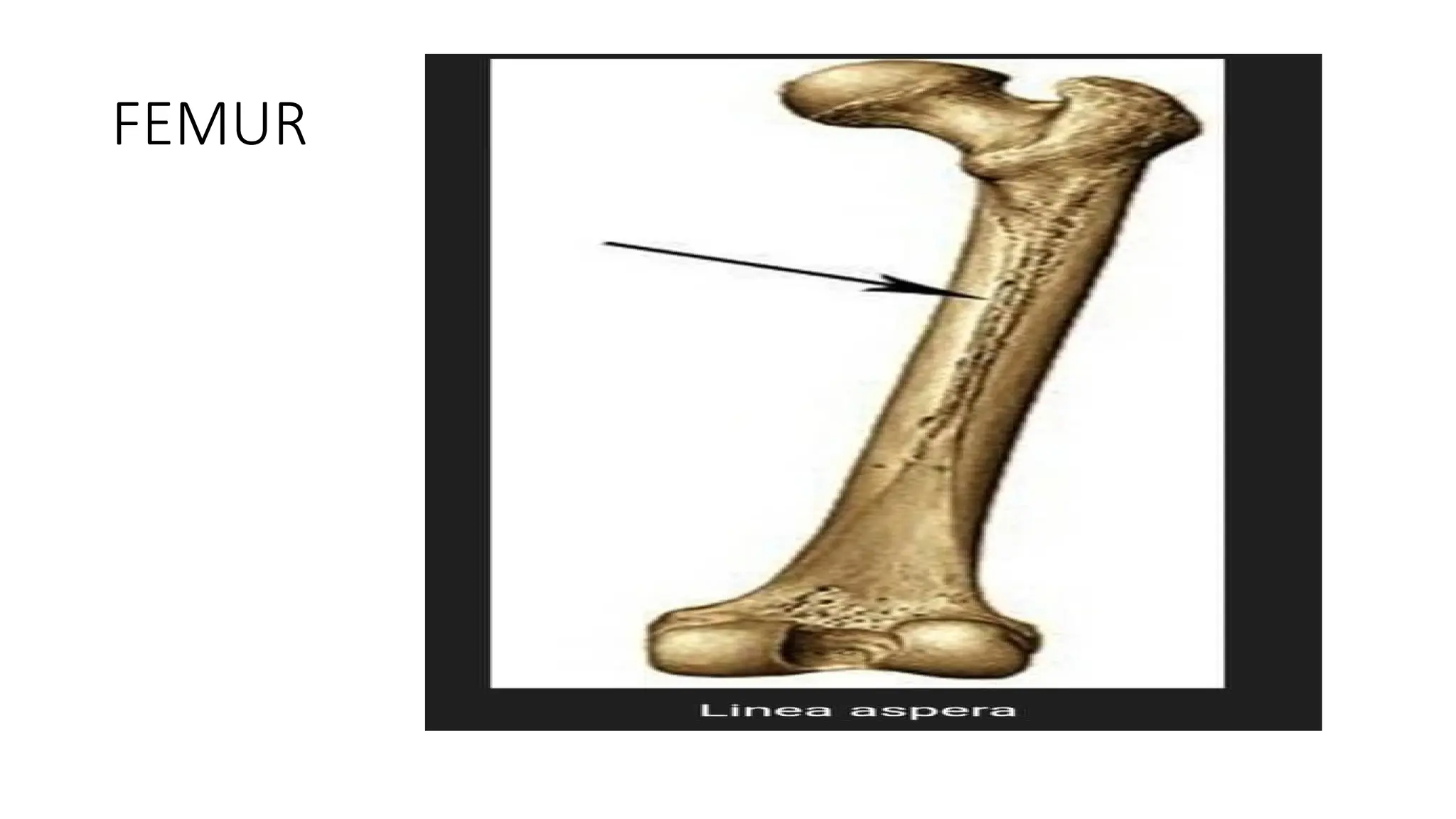 FEMUR FRACTURES- Head and Neck and classification | PPTX