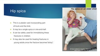 fracture of shaft of femur | PPTX