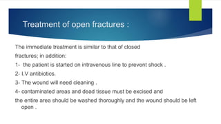 fracture of shaft of femur | PPTX