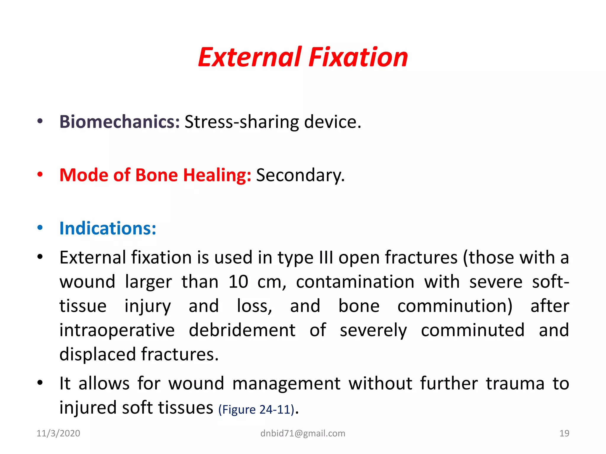 Femur shaft fractures Physiotherapy | PPTX