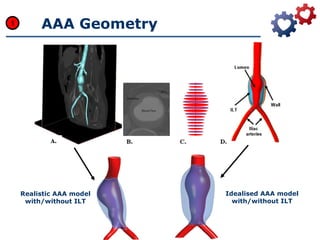 Fluid structure interaction in abdominal aortic aneurysm using ANSYS ...