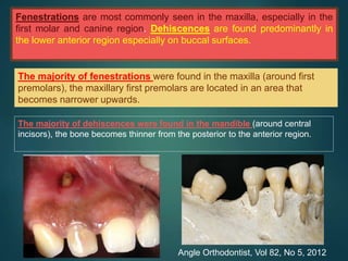Fenestration and dehiscence | PPTX