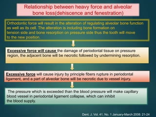 Fenestration and dehiscence | PPTX