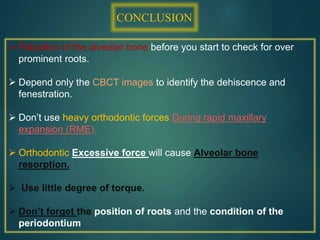 Fenestration and dehiscence | PPTX