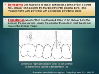 Fenestration and dehiscence | PPTX