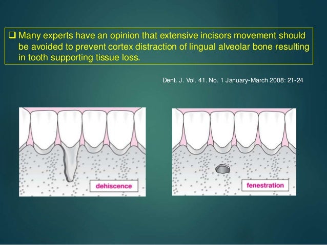 Fenestration and dehiscence