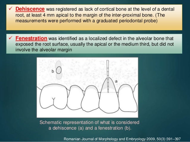 Fenestration and dehiscence
