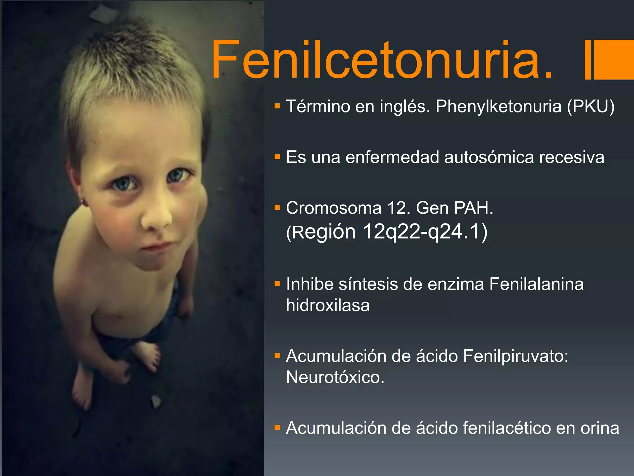 Fenilcetonuria Ppt