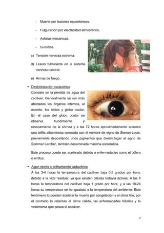 Fenómenos cadavéricos | PDF