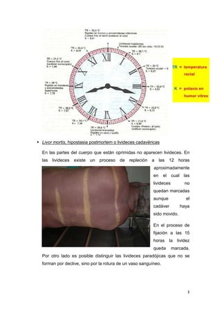 Fenómenos cadavéricos | PDF