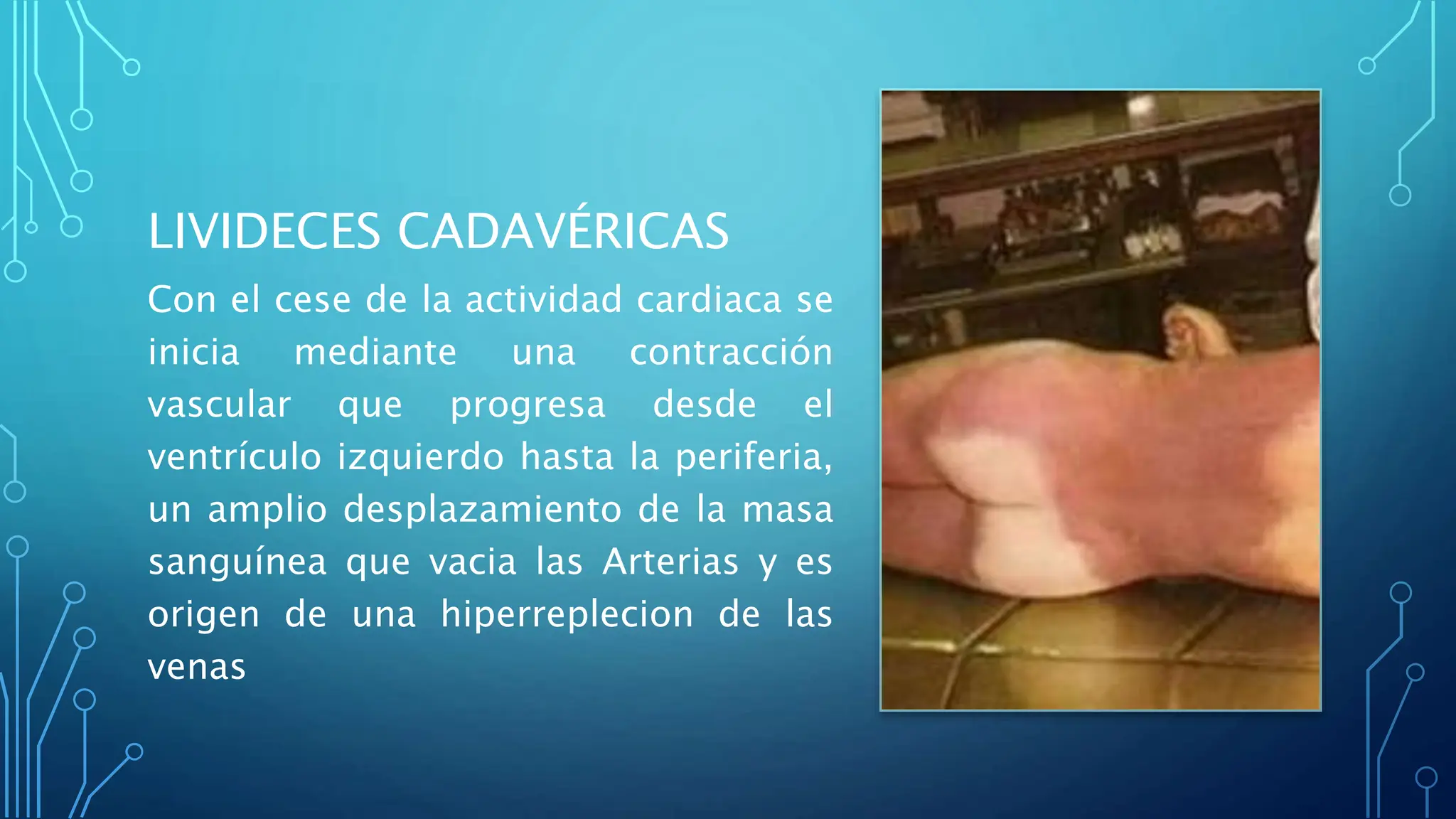 Fenómenos cadavéricos tempranos y tardios | PPTX