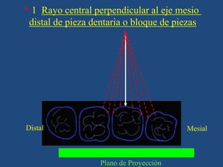 Fenómenos Proyeccionales Específicos. Intraoral Periapical | PPTX