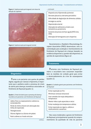 Fenômeno de Raynaud - Documento Científico da SBP | PDF
