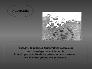 Fenomenos Cadavericos | PPT