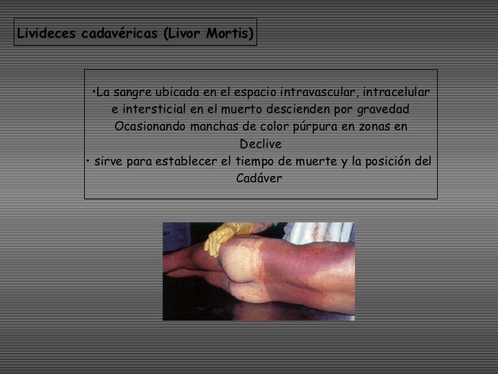 Fenomenos Cadavericos