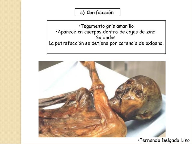 Fenomenos cadavericos-tardios