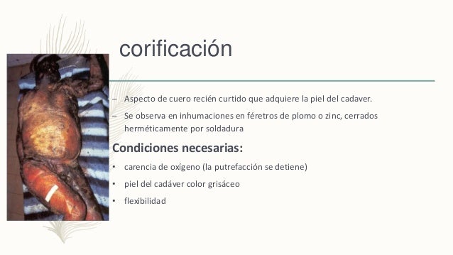 Fenomenos cadavericos