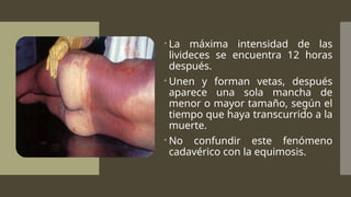 DESCRIPCION DE LOS fenomenos cadavericos | PPTX