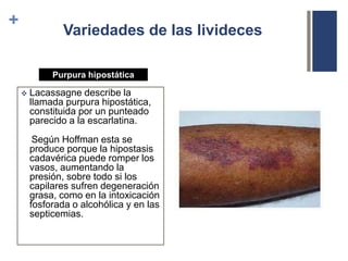 Fenómenos cadavéricos | PPTX