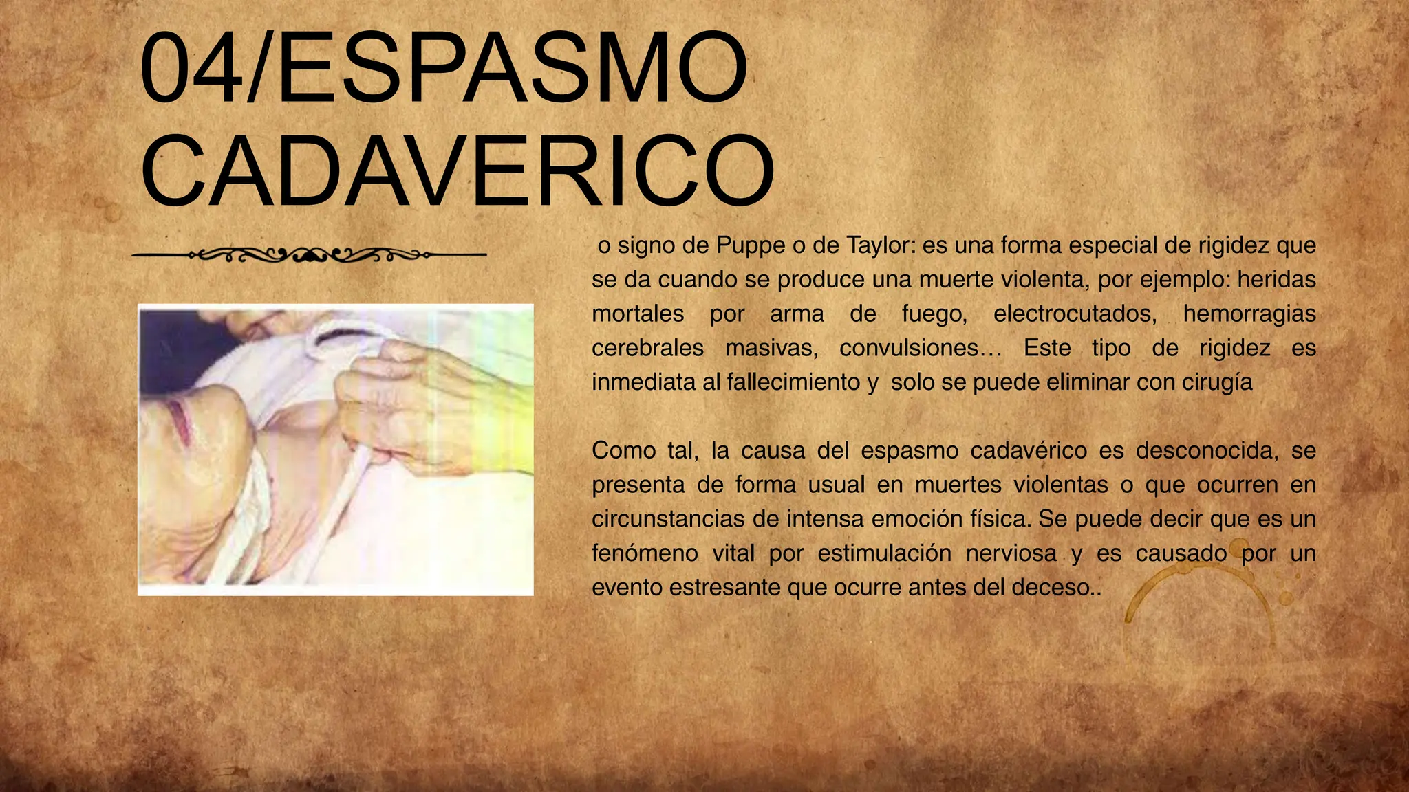 FENOMENOS CADAVERICOS TEMPRANOS.PDF (1) (1).pptx