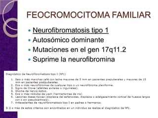 Feocromocitoma | PPTX
