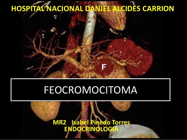 Feocromocitoma