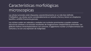 Feocromocitoma.pptx