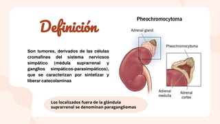 Feocromocitoma.pptx