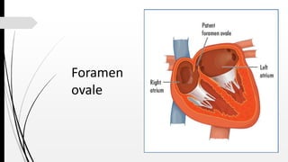 feotal circualtion 10 ppt.pptx