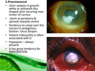 Ferdous bacterial keratitis copy | PPT